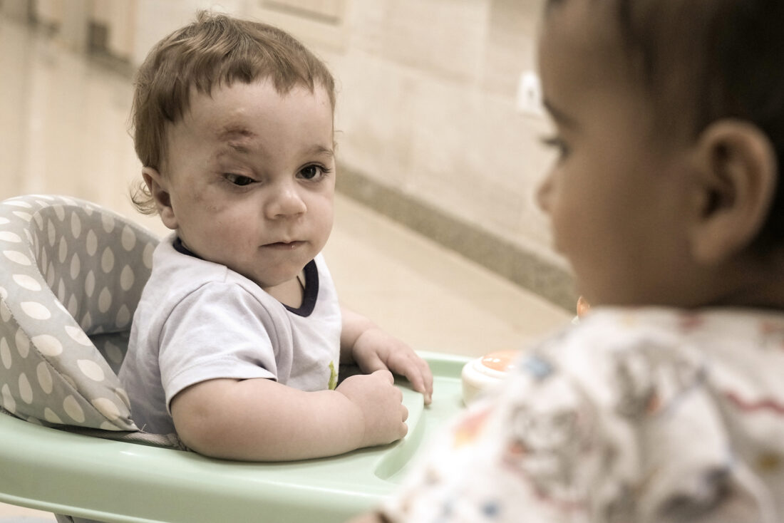 A baby evacuated from Gaza lost an eye and most of his family in the ...